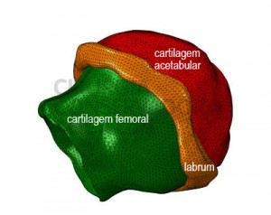 Anca - Cirurgia Conservadora Anca