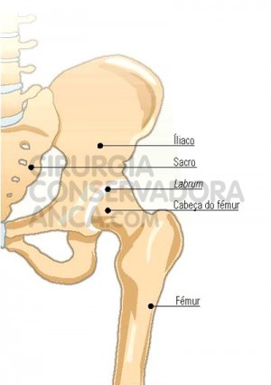 Anca - Cirurgia Conservadora Anca